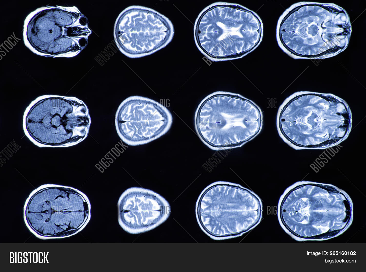 X-ray Image Brain Image & Photo (Free Trial) | Bigstock