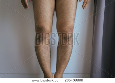 Asian Man Leg Bandy- Image & Photo (Free Trial) | Bigstock