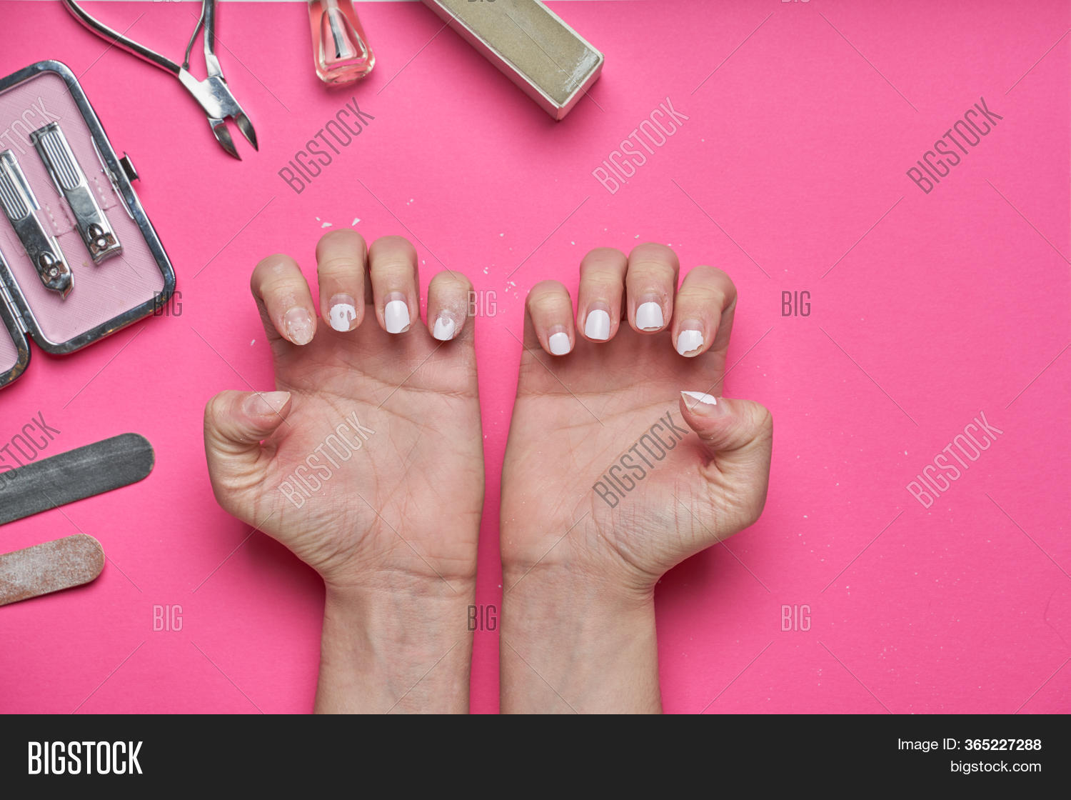 Overgrown Nails Old Image & Photo (Free Trial) | Bigstock
