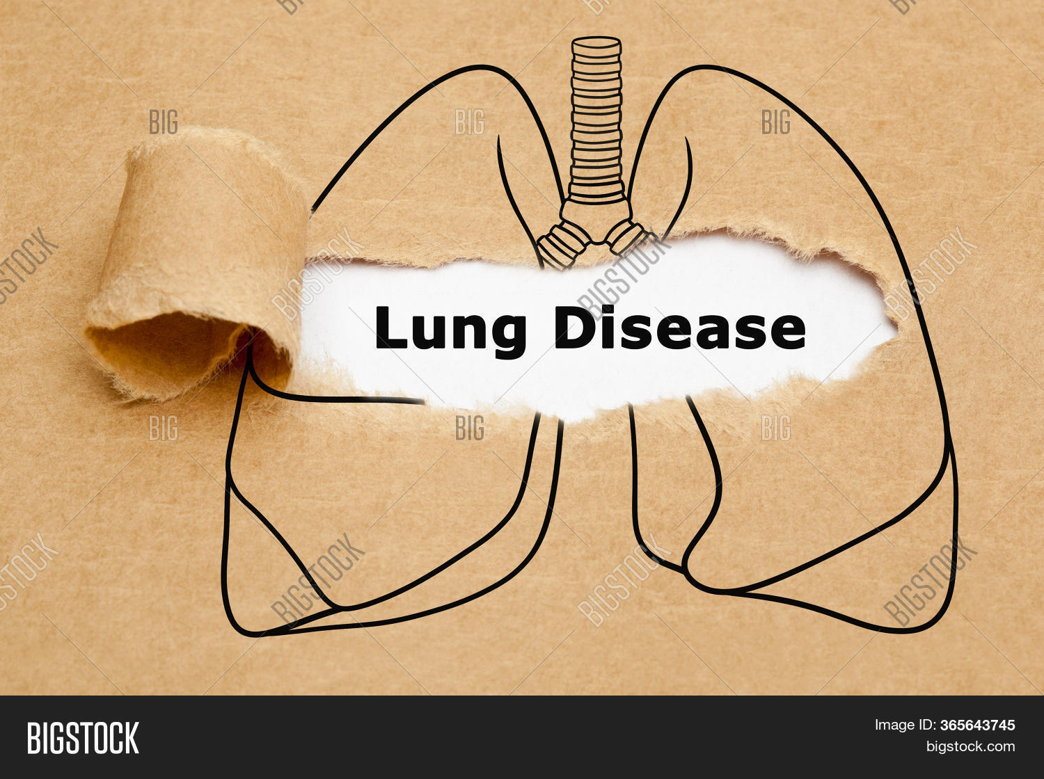 Text Lung Disease Image & Photo (Free Trial) | Bigstock
