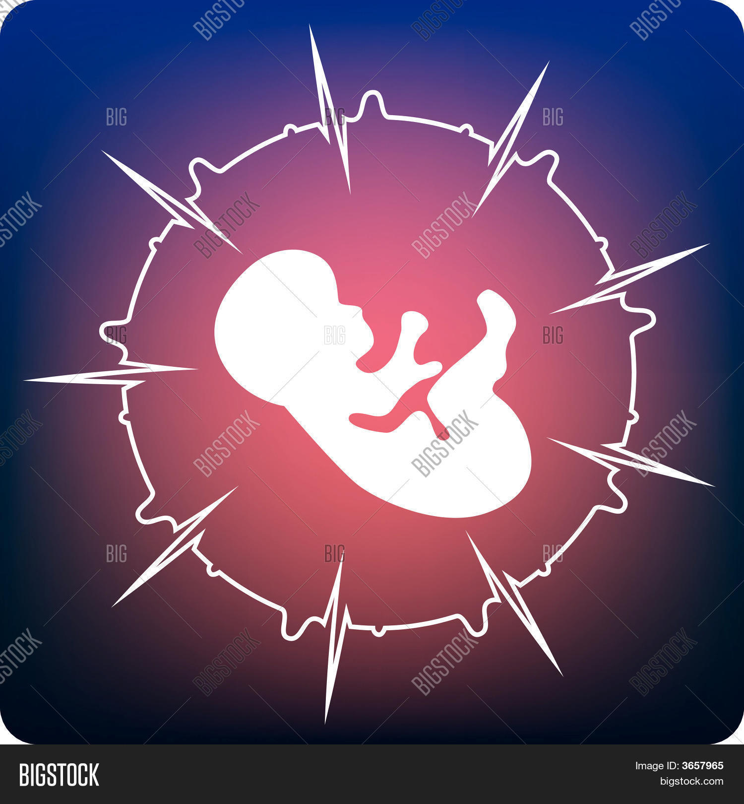 Neonatal Vector & Photo (Free Trial) | Bigstock