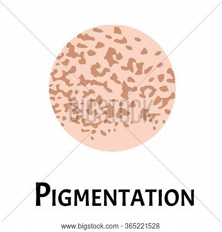 Pigmentation On Skin Vector & Photo (Free Trial) | Bigstock
