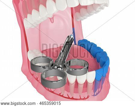 3d Render Human Jaw Image & Photo (Free Trial) | Bigstock