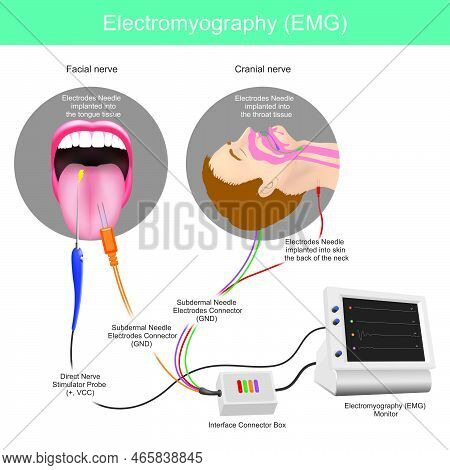 Electromyography. Vector & Photo (Free Trial) | Bigstock