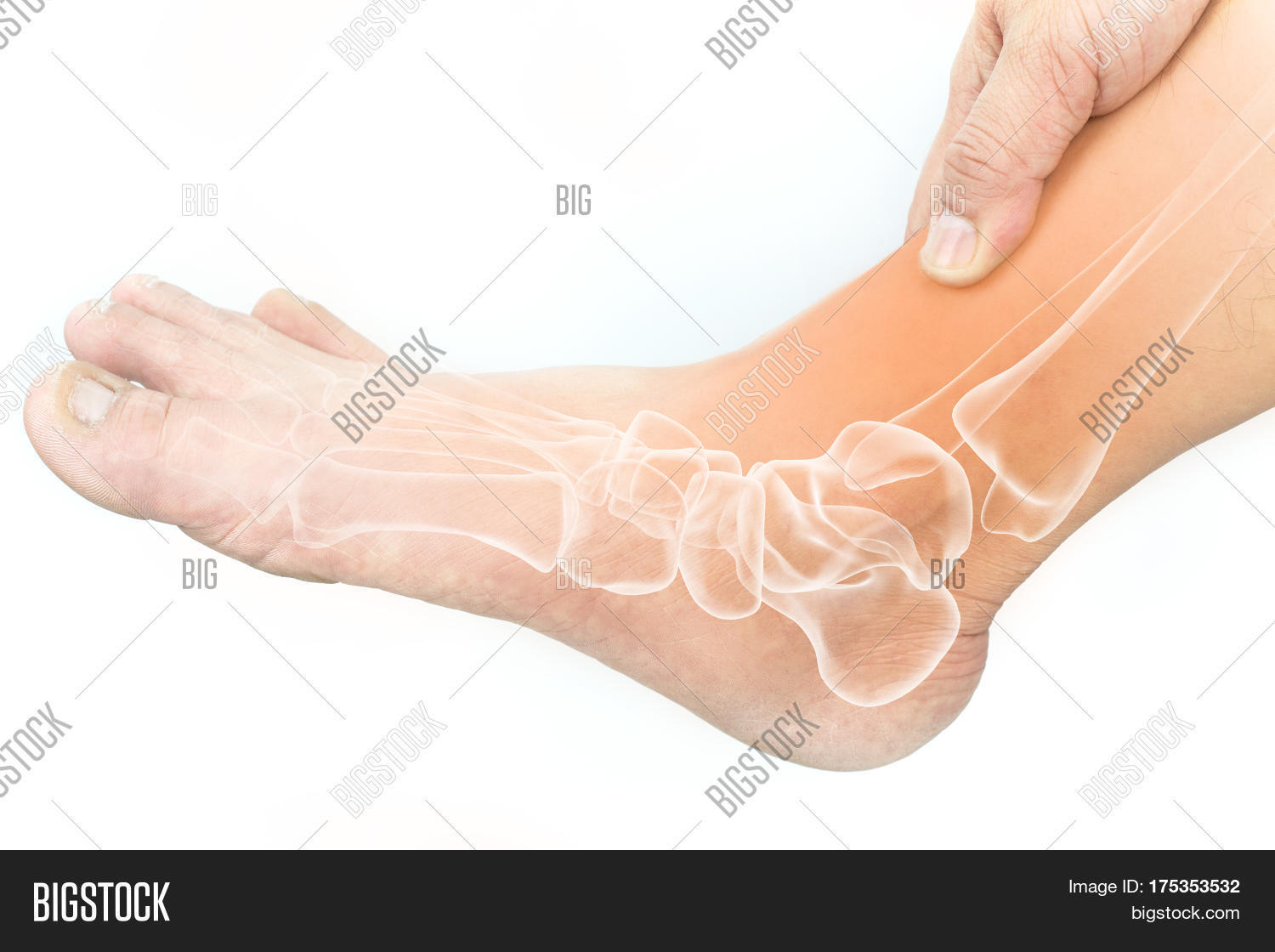 Foot Muscle Pain White Image & Photo (Free Trial) | Bigstock