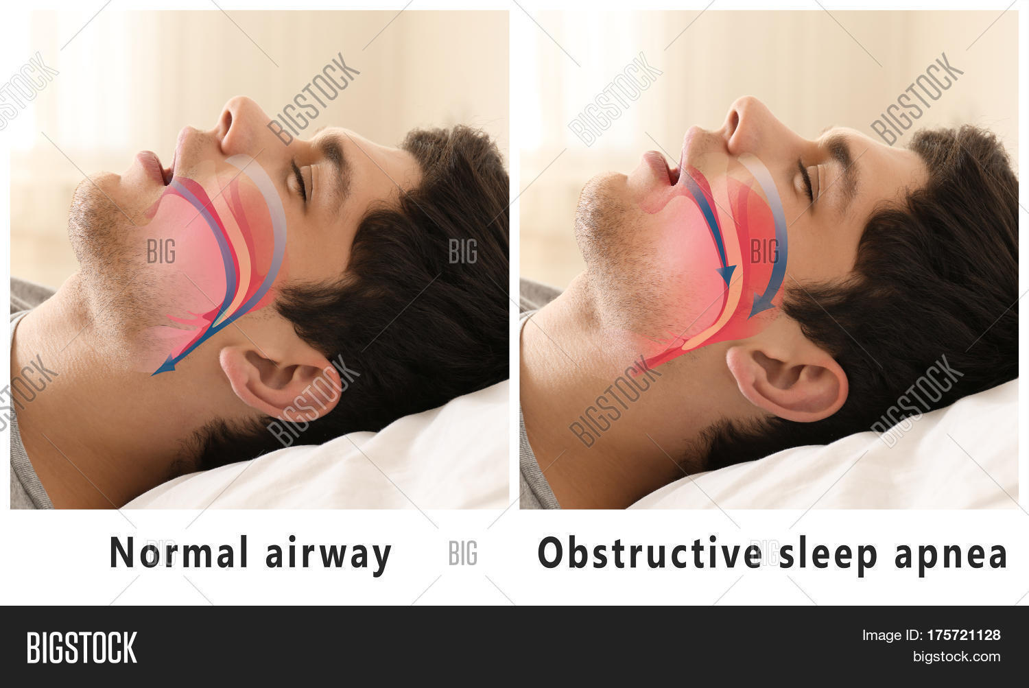 Snore Problem Concept Image & Photo (Free Trial) | Bigstock