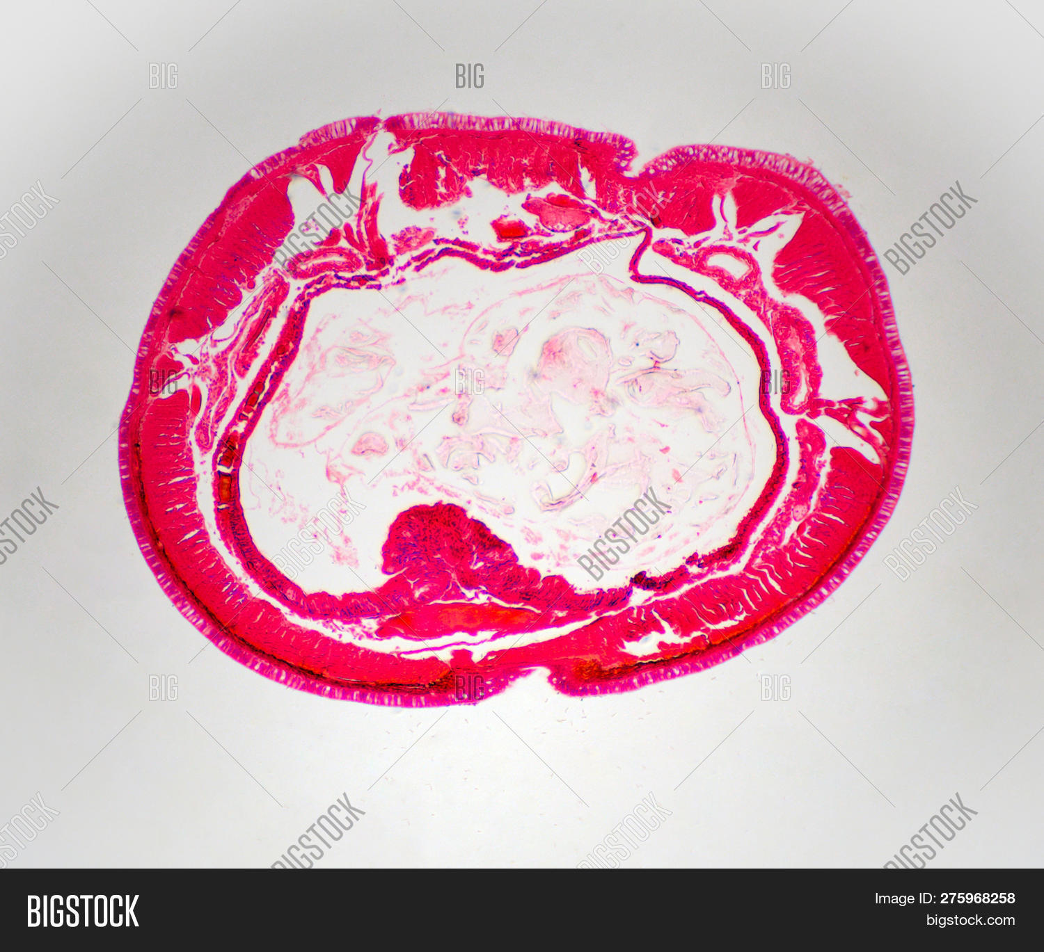 Thin Cross Section Image & Photo (Free Trial) | Bigstock