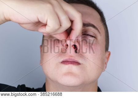 Man's Nose Started Image & Photo (Free Trial) | Bigstock