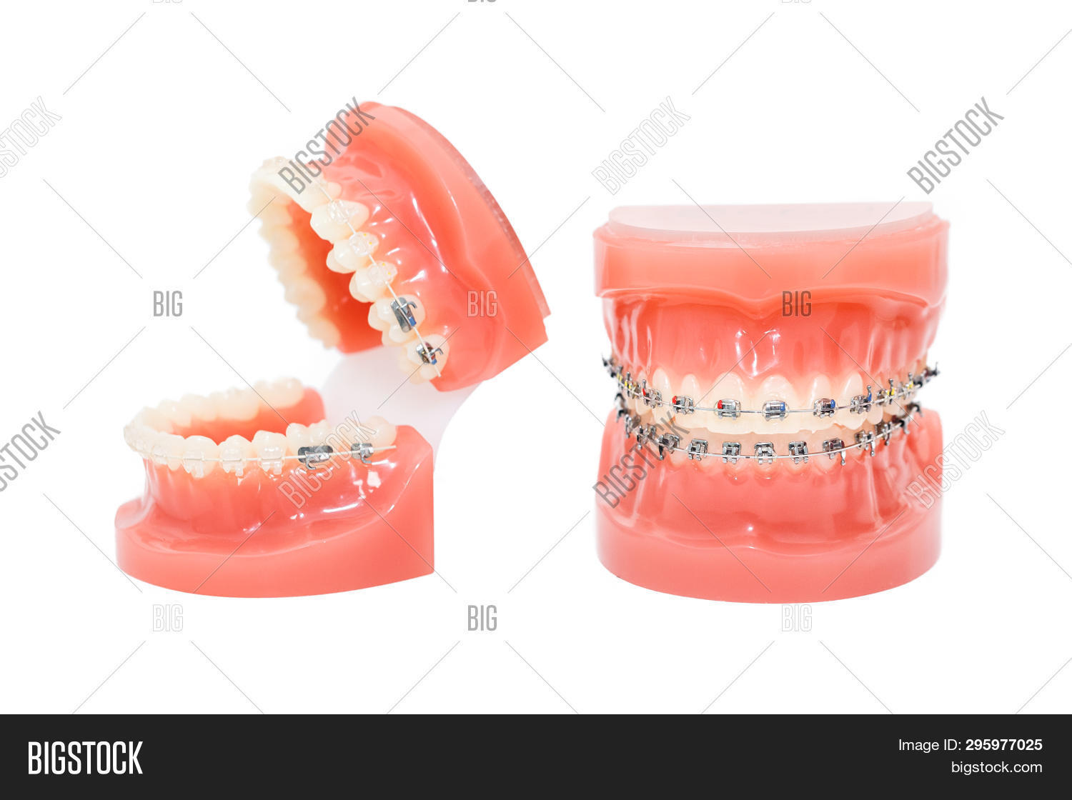 Orthodontic Model Image & Photo (Free Trial) | Bigstock