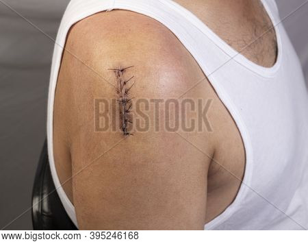 Imagen y foto Close- Surgical (prueba gratis) | Bigstock