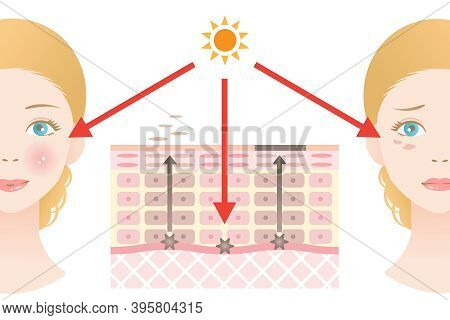 Diagram Melanin Facial Image & Photo (Free Trial) | Bigstock