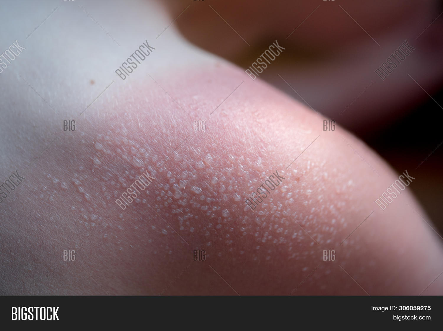 Skin Care Concept Image And Photo Free Trial Bigstock