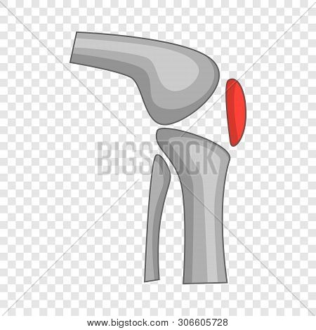 Knee Replacement Vector & Photo (Free Trial) | Bigstock