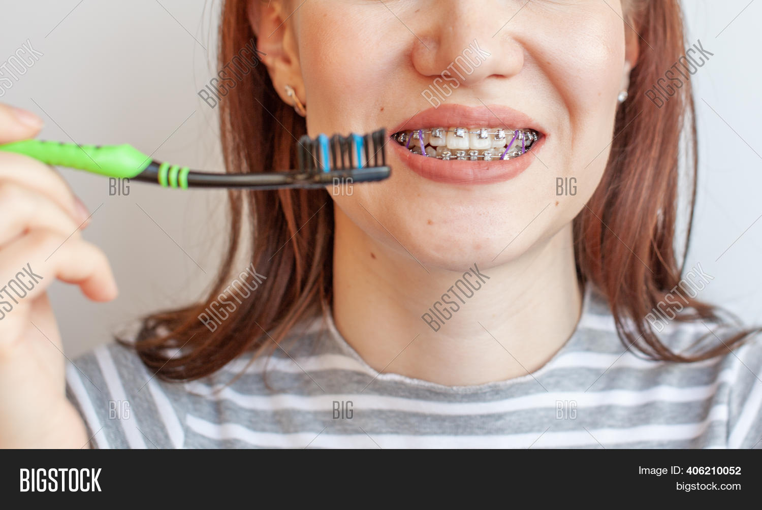 Braces Girls Smiling Image And Photo Free Trial Bigstock