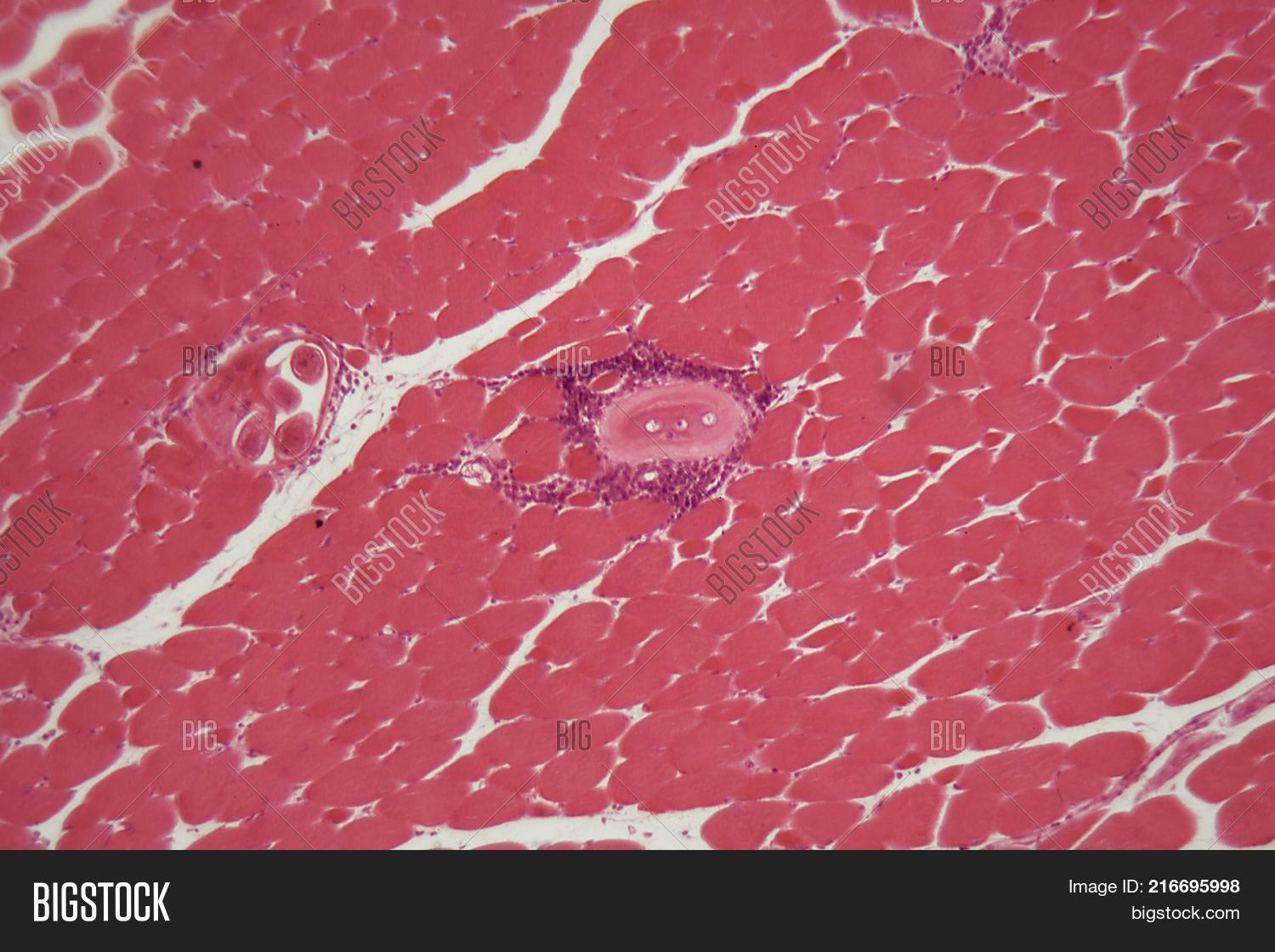 Trichinella Spiralis Image & Photo (Free Trial) | Bigstock