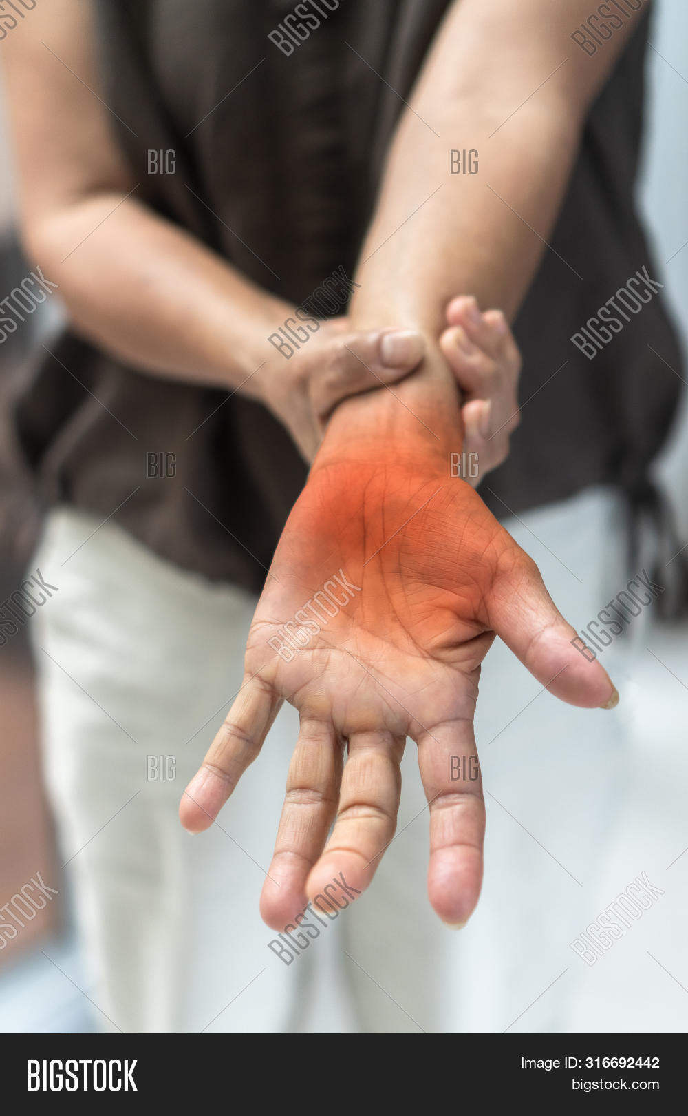 Peripheral Neuropathy Image & Photo (Free Trial) | Bigstock