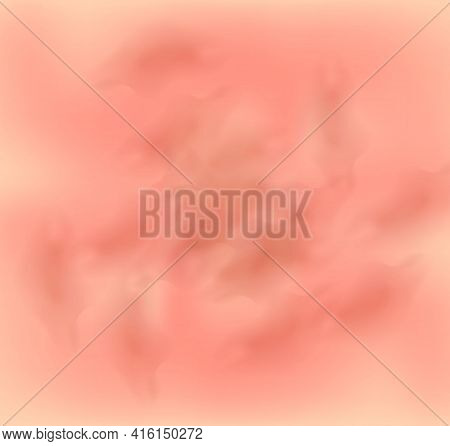 Skin Inflammation. Vector & Photo (Free Trial) | Bigstock