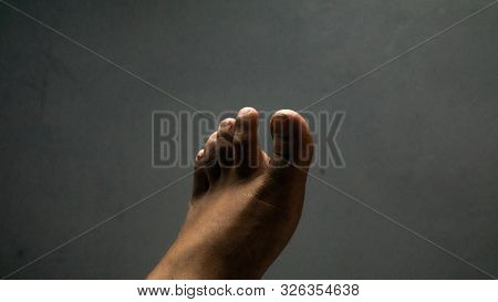 Close View Human Toes Image & Photo (Free Trial) | Bigstock