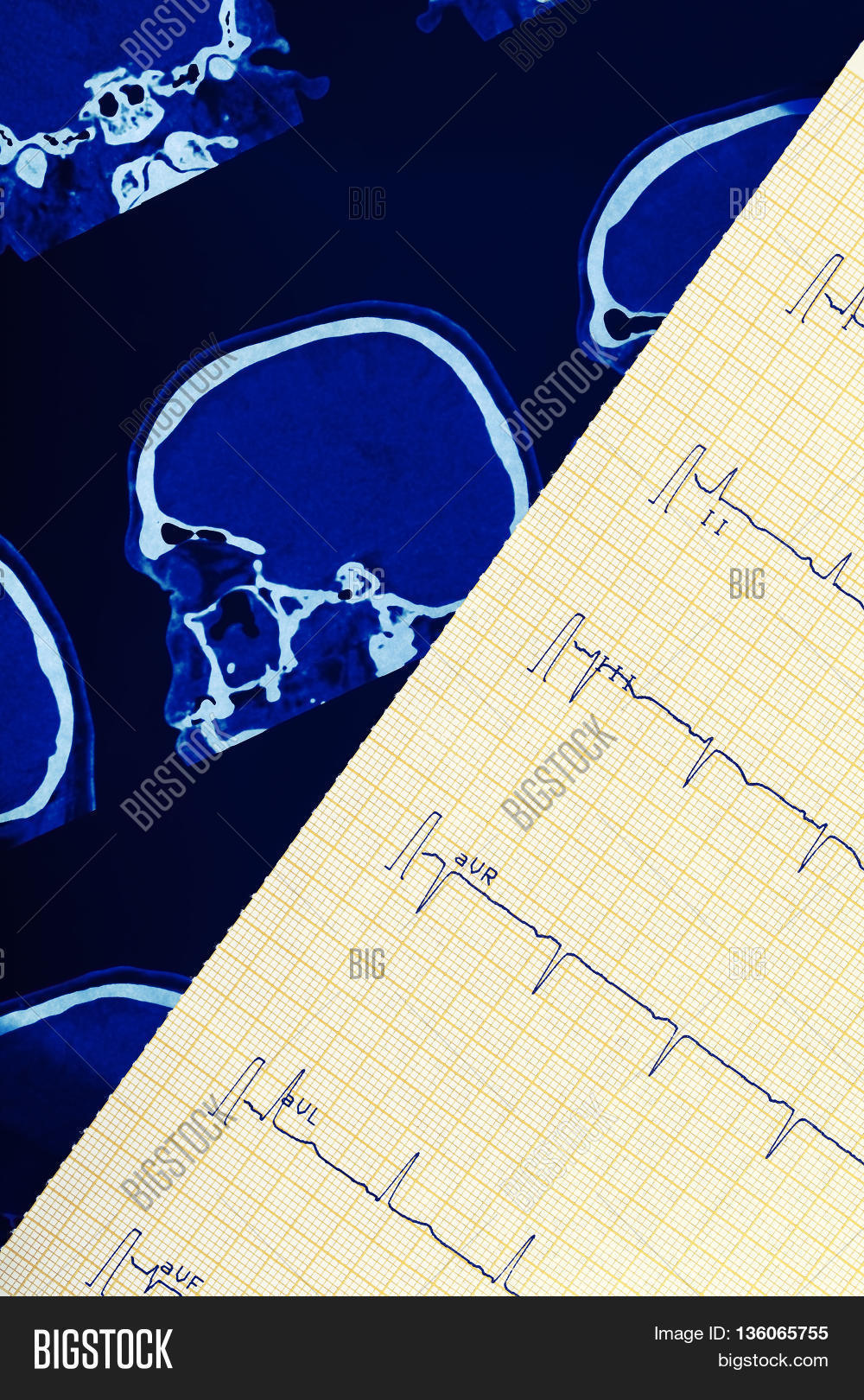 ECG Ct Scan Human Image & Photo (Free Trial) | Bigstock