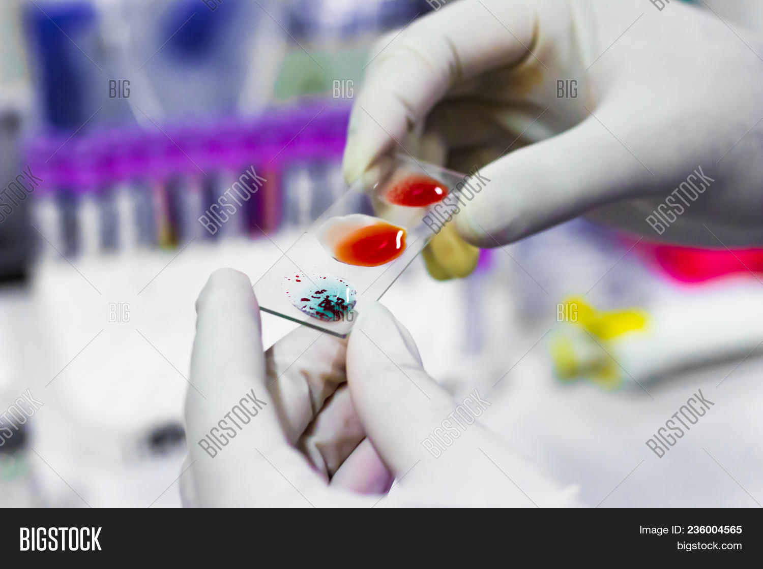 Blood Grouping On Image & Photo (Free Trial) | Bigstock