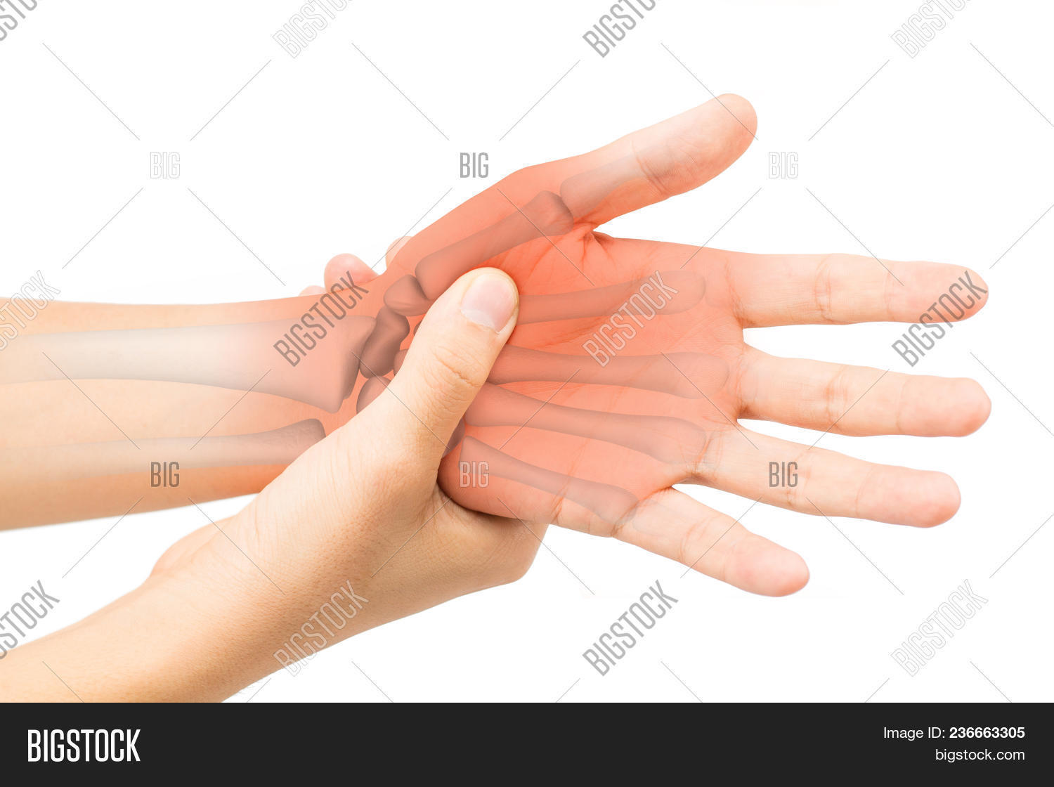 Hand Bone Pain White Image & Photo (Free Trial) | Bigstock