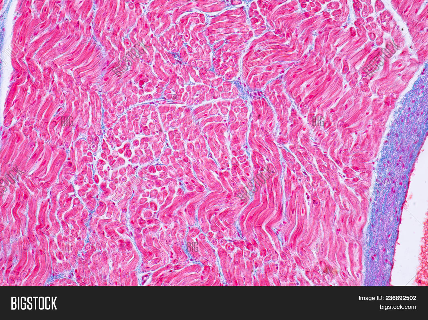 Histology Human Cardiac Muscle Under Microscope Stock Photo | My XXX ...