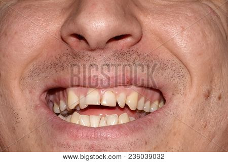 Mouth Man Crooked Image & Photo (Free Trial) | Bigstock