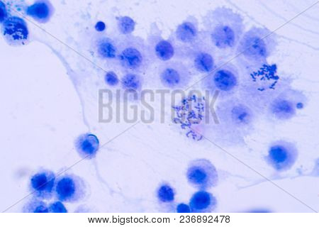 Human Chromosomes Image & Photo (Free Trial) | Bigstock