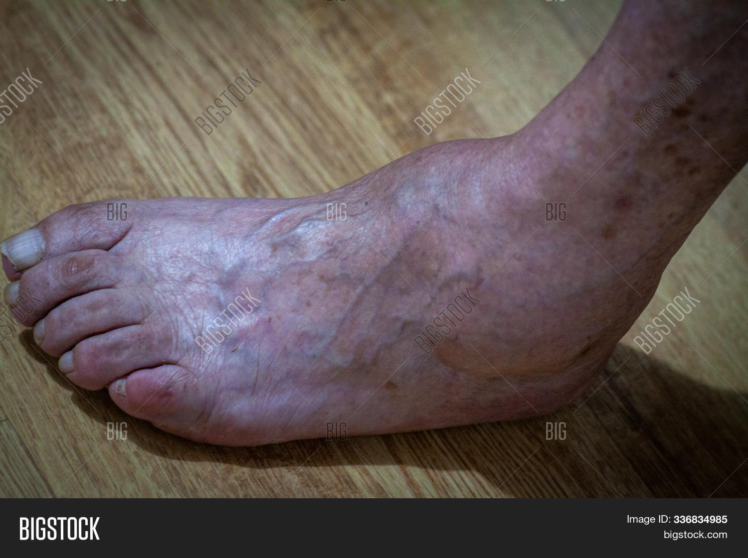 Closeup Feet Old Man Image & Photo (Free Trial) | Bigstock