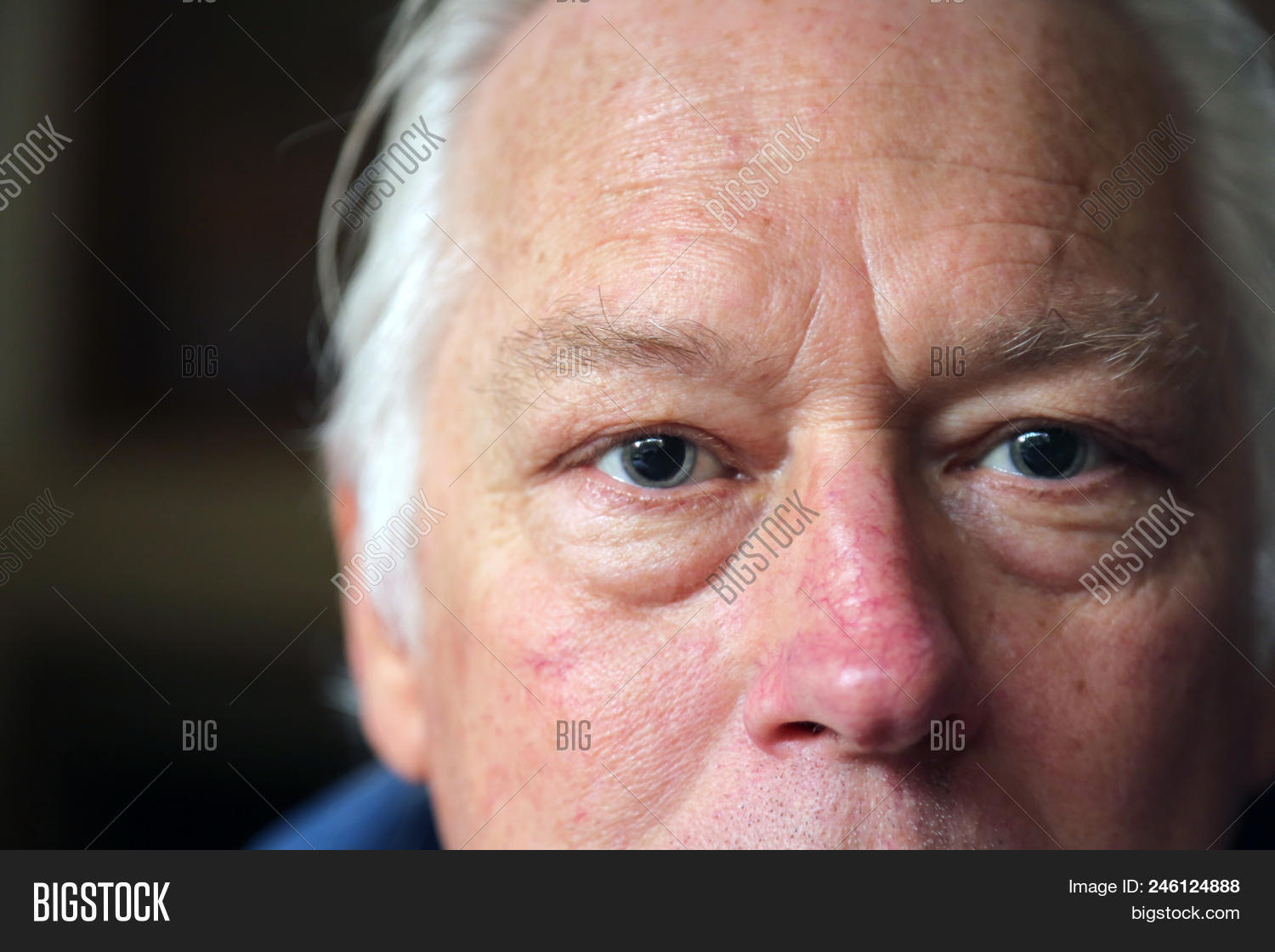 Dilated Human Eye. Image & Photo (Free Trial) | Bigstock