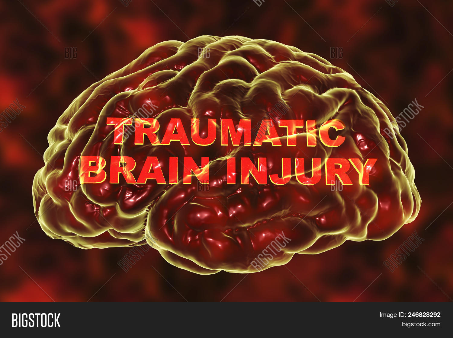 Traumatic Injury Human Image & Photo (Free Trial) | Bigstock