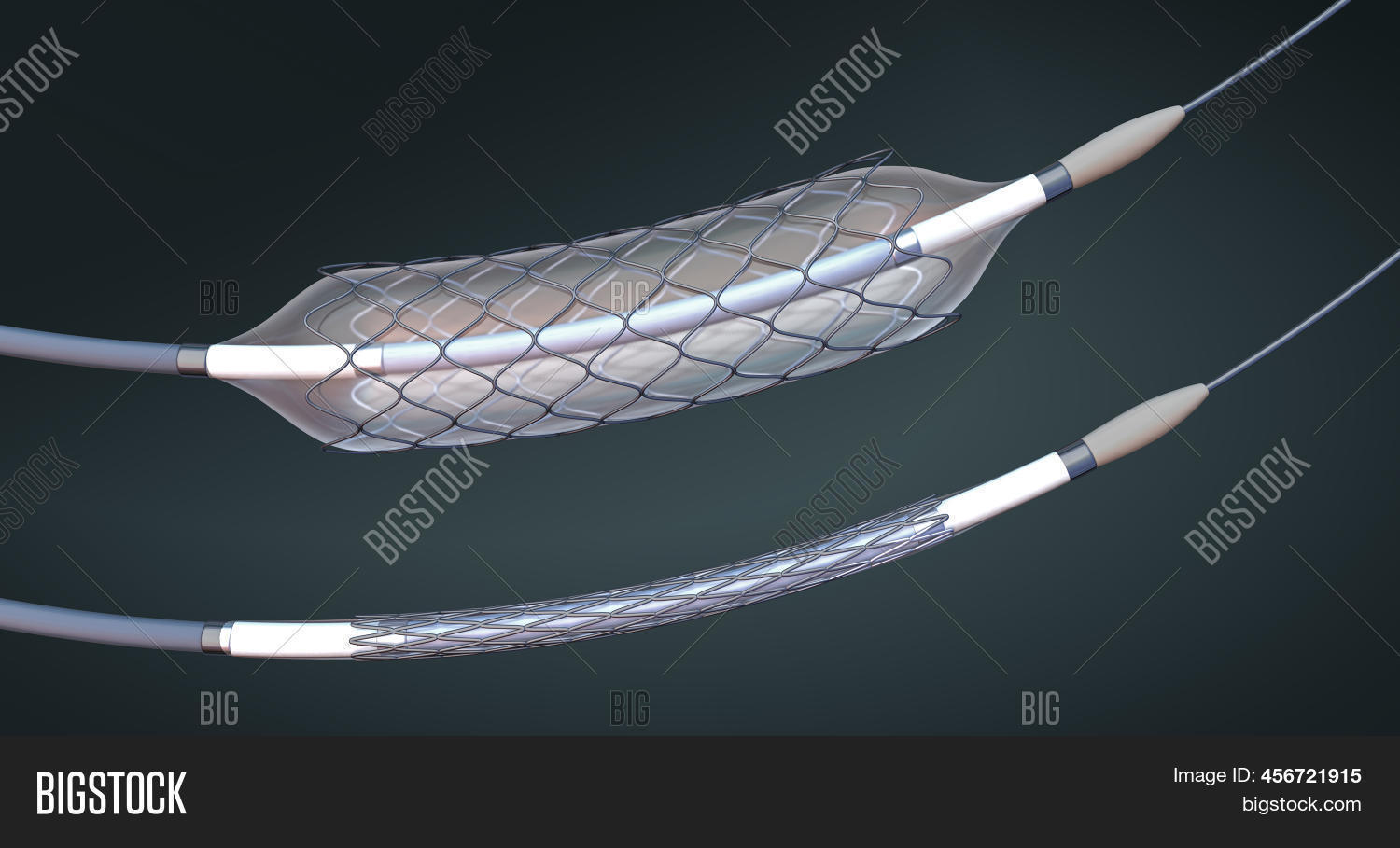 Stent Catheter Image & Photo (Free Trial) | Bigstock