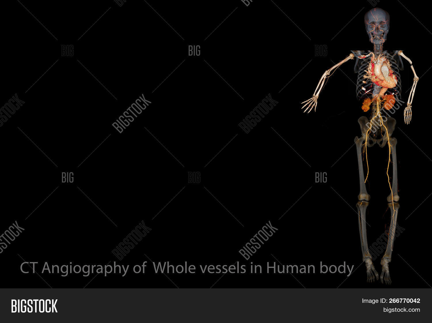 Ct Scan Imaging 3d Image & Photo (Free Trial) | Bigstock