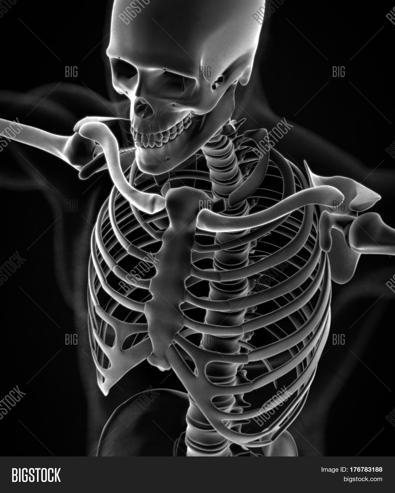 Collar Bone Xray. Image & Photo (Free Trial) | Bigstock
