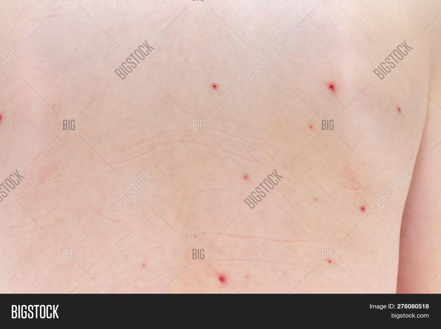 Closeup Back Boy Image & Photo (Free Trial) | Bigstock