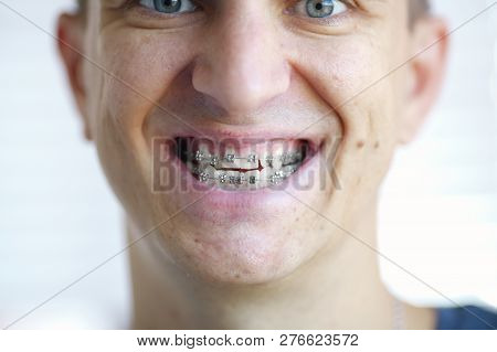 Portrait Man Crooked Image & Photo (Free Trial) | Bigstock