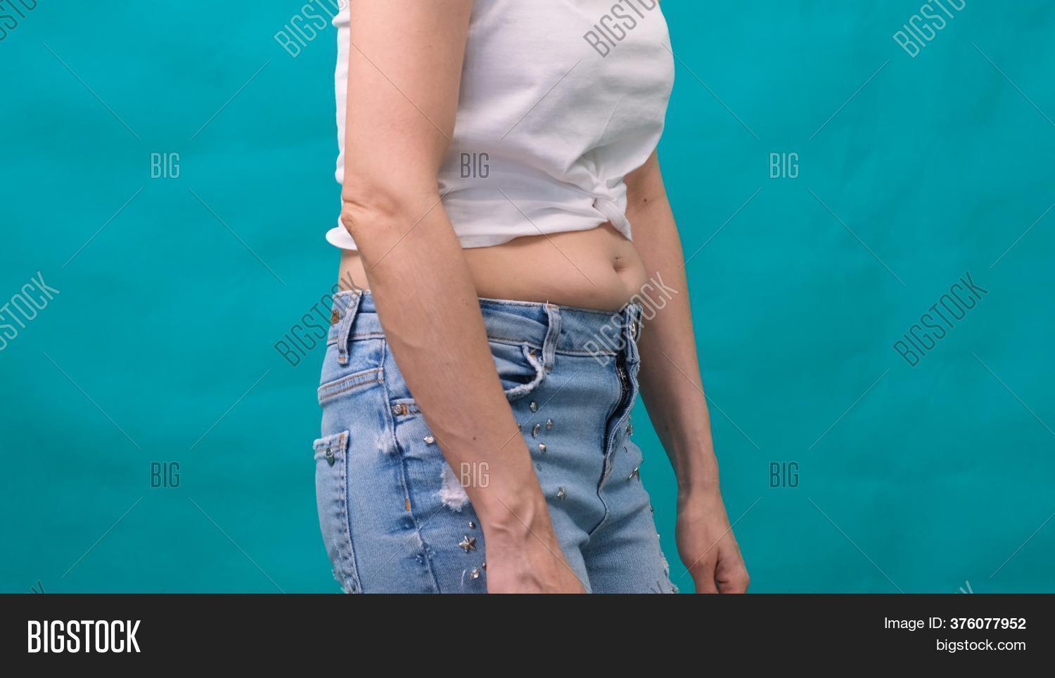 Woman Holds Fold Skin Image & Photo (Free Trial) | Bigstock