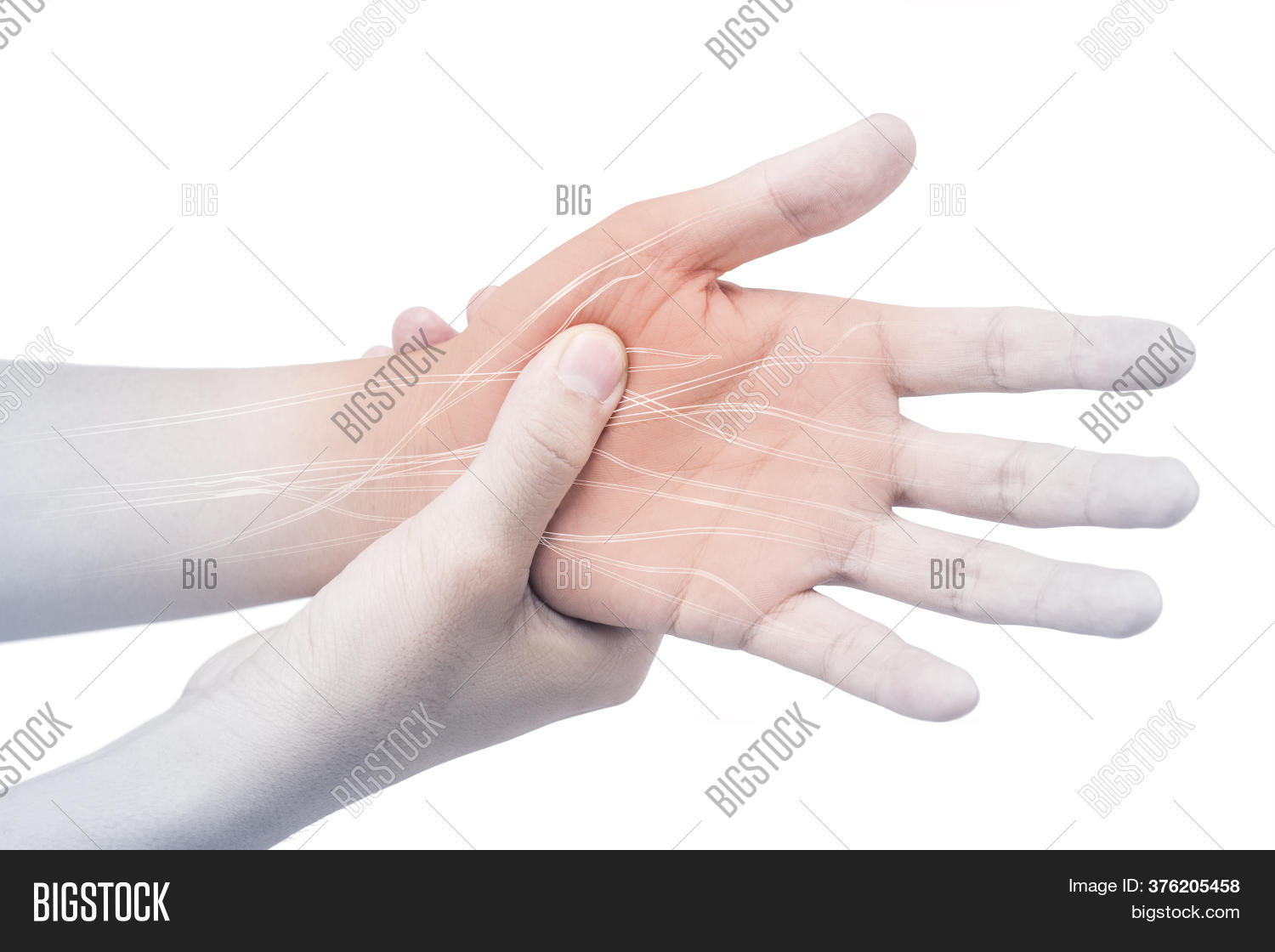 Hand Nerve Pain White Image & Photo (Free Trial) | Bigstock