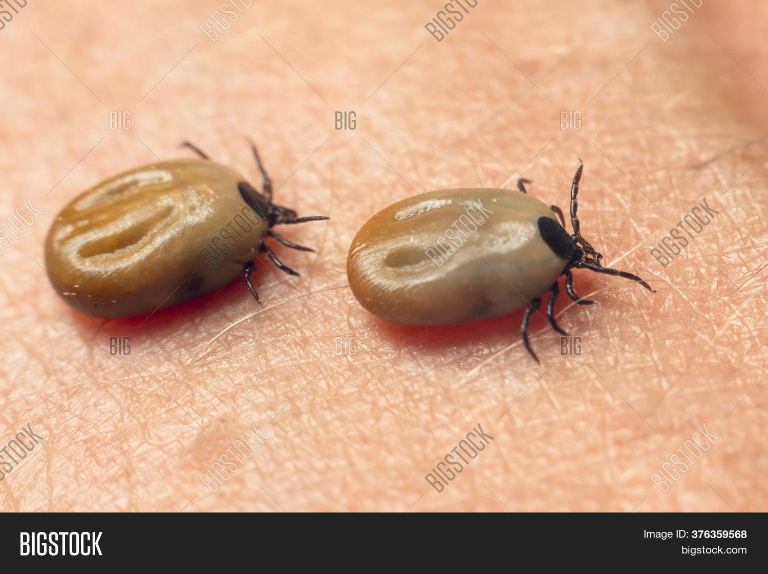 Tick Drunk On Blood Image & Photo (Free Trial) | Bigstock