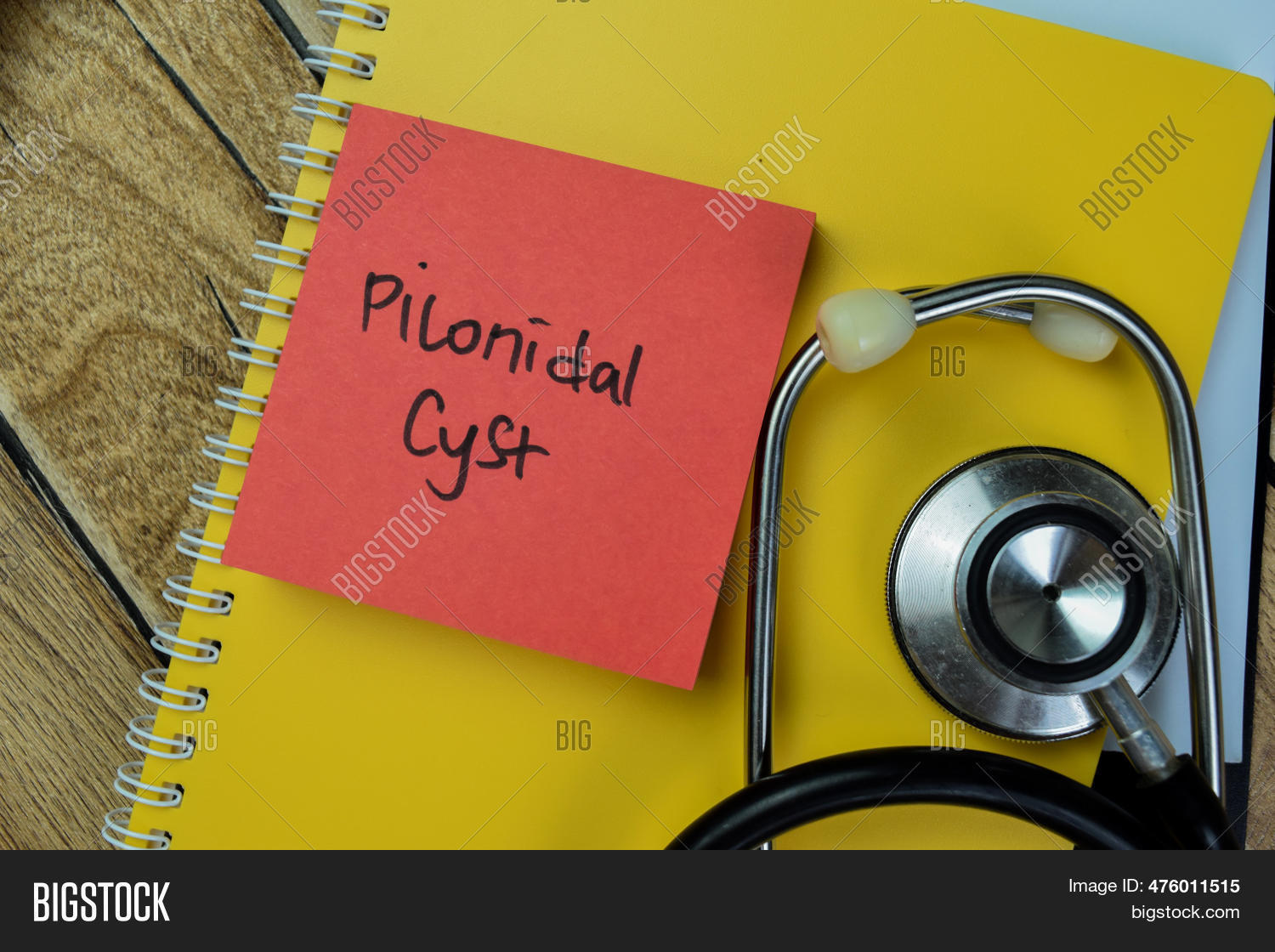 Concept Pilonidal Cyst Image & Photo (Free Trial) | Bigstock