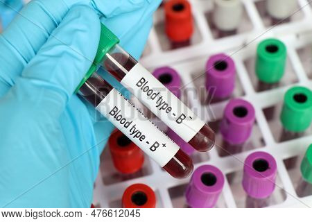 Blood Type B Rh Image & Photo (Free Trial) | Bigstock