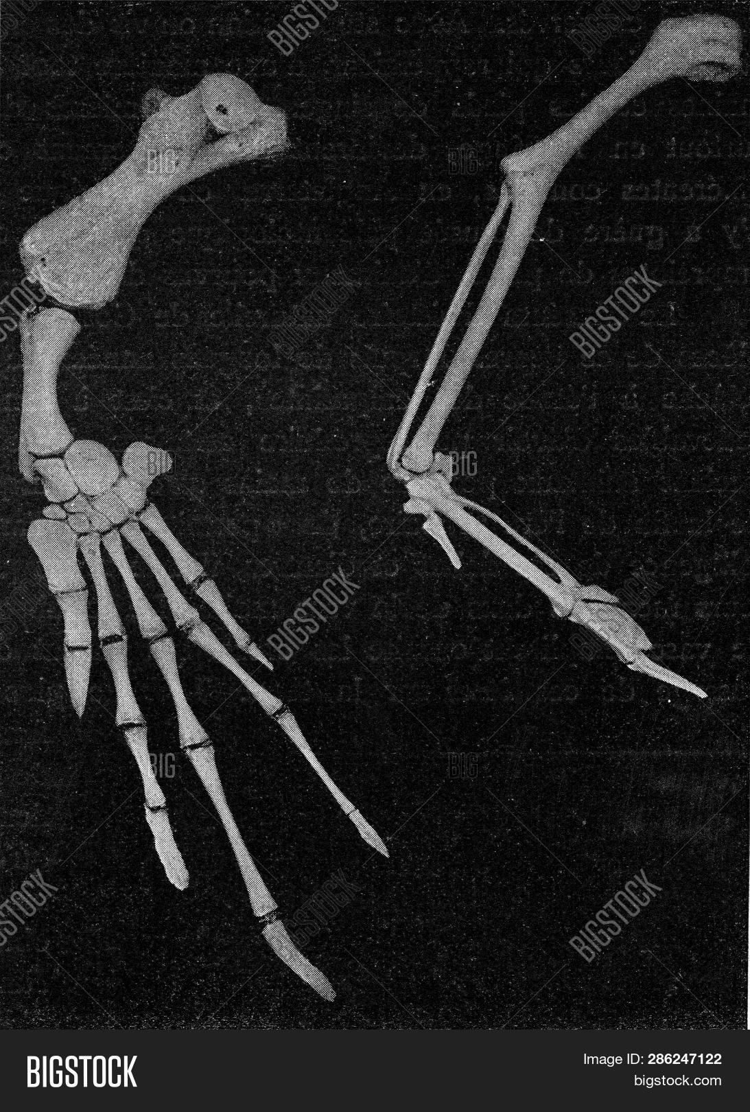 Skeleton Arm Turtle Image & Photo (Free Trial) | Bigstock