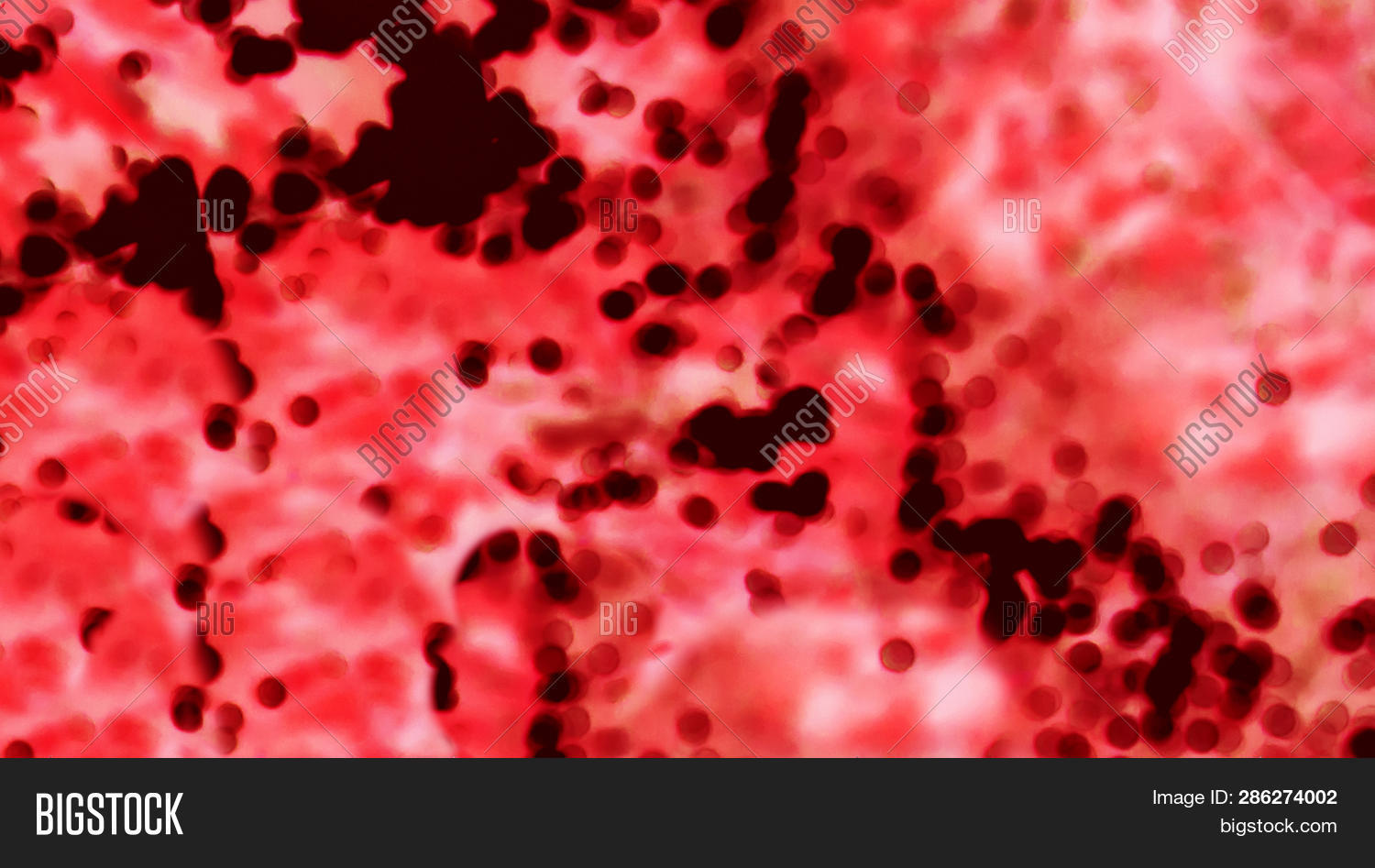 Blood Corpuscles Image & Photo (Free Trial) | Bigstock