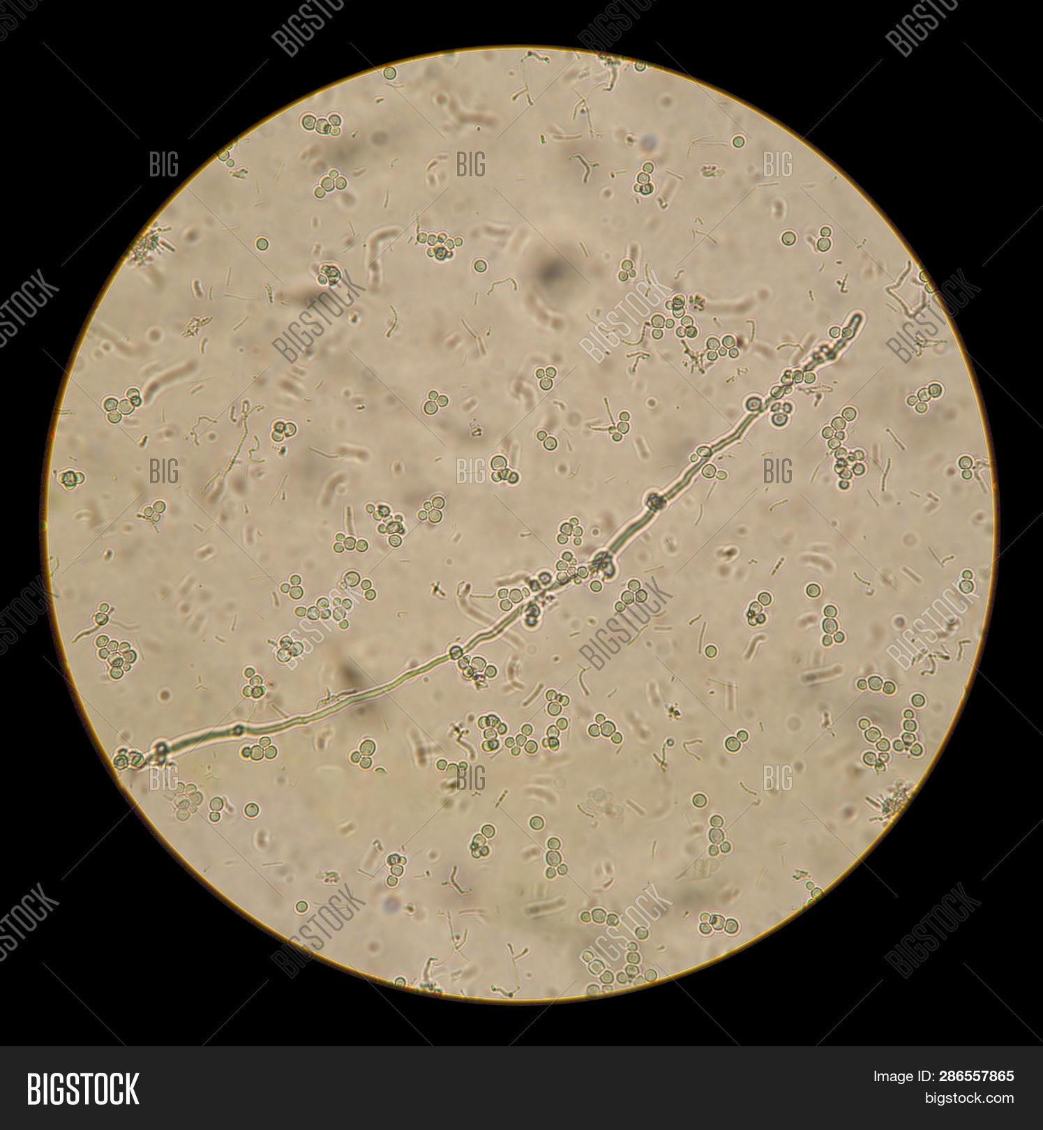 Microscopic View Fungi Image & Photo (Free Trial) | Bigstock