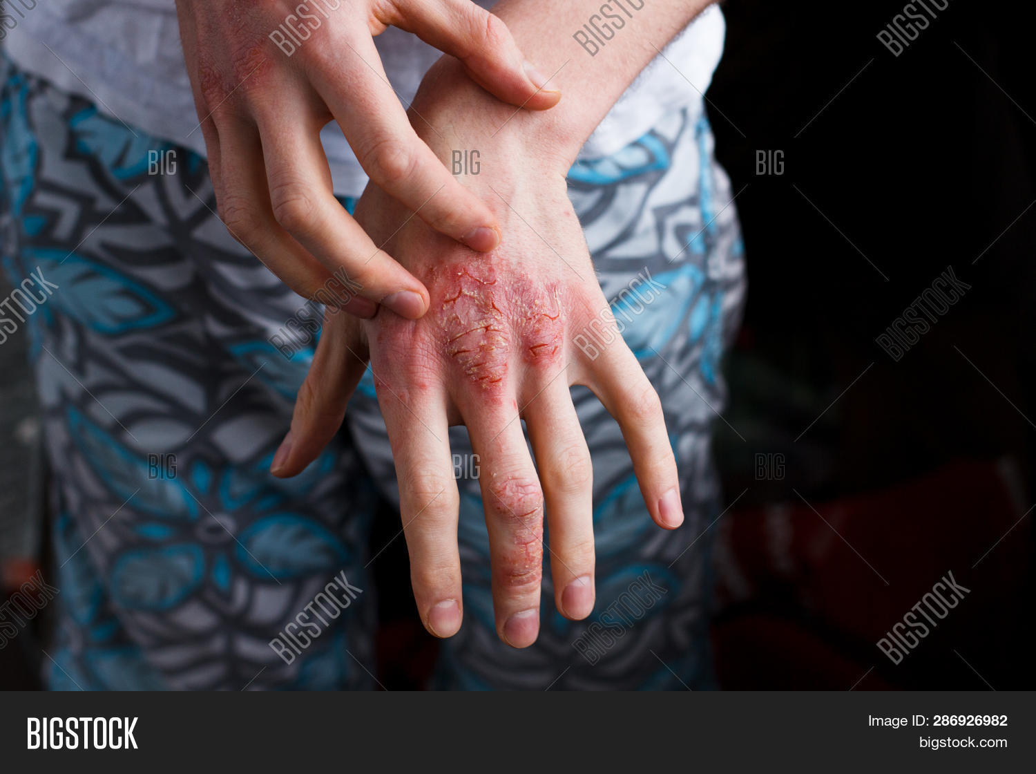Closeup Men Itching Image & Photo (Free Trial) | Bigstock