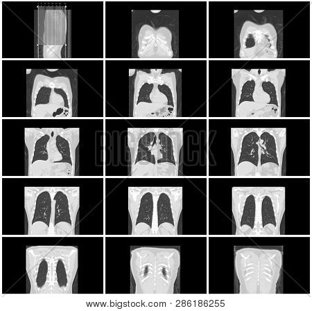 Imagen y foto Ct Scan Step Set (prueba gratis) | Bigstock