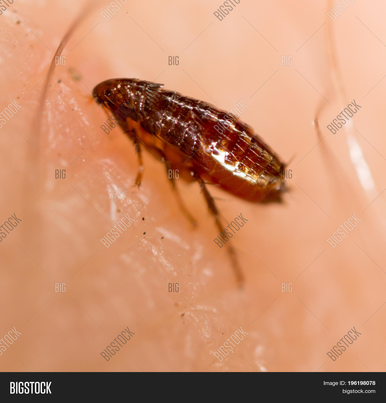 Flea On Human Skin. Image & Photo (Free Trial) | Bigstock