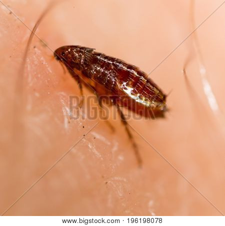 Flea On Human Skin. Image & Photo (Free Trial) | Bigstock