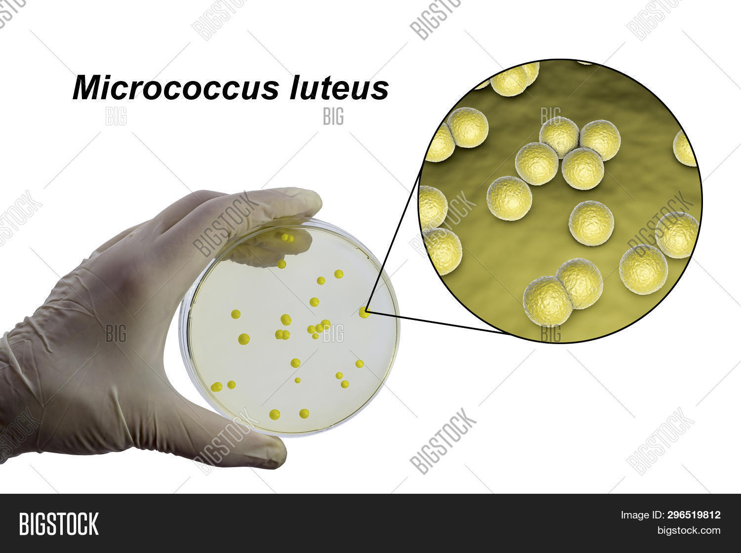 Colonies Micrococcus Image & Photo (Free Trial) | Bigstock