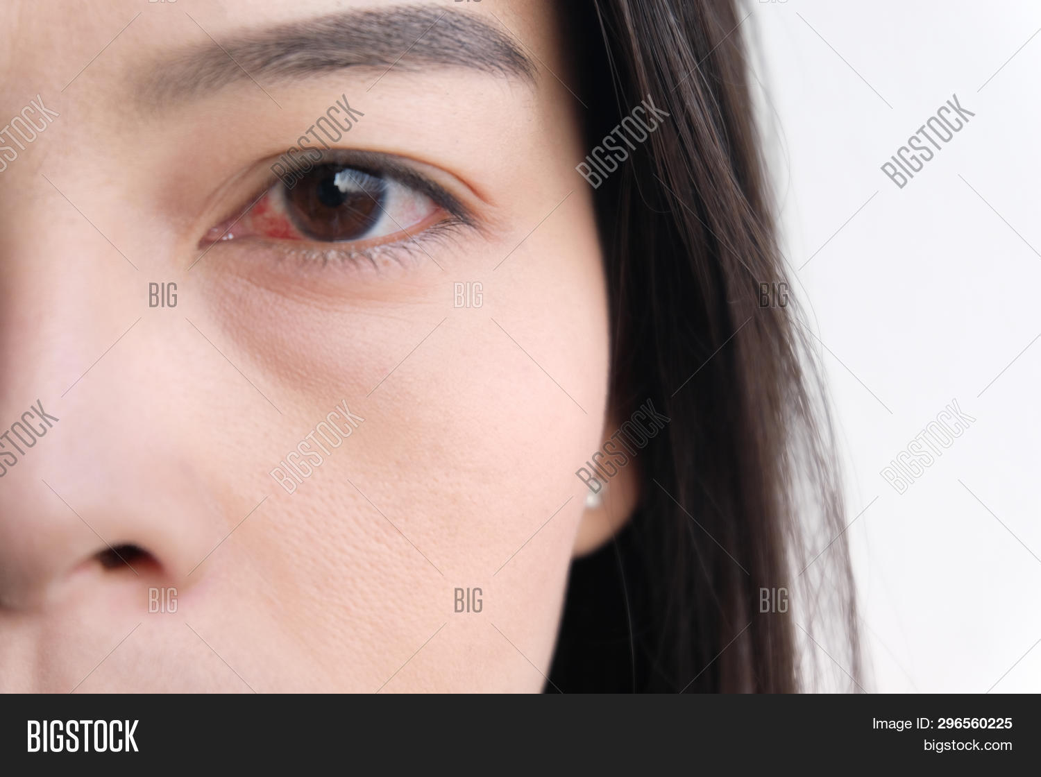 Red Eye. Image & Photo (Free Trial) | Bigstock
